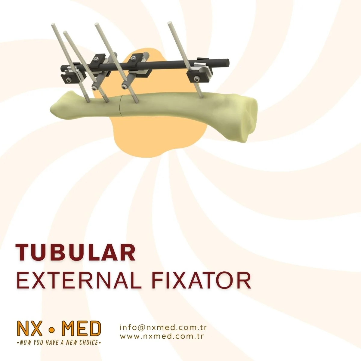 External Fixator System - Tubular Fixator Parts
