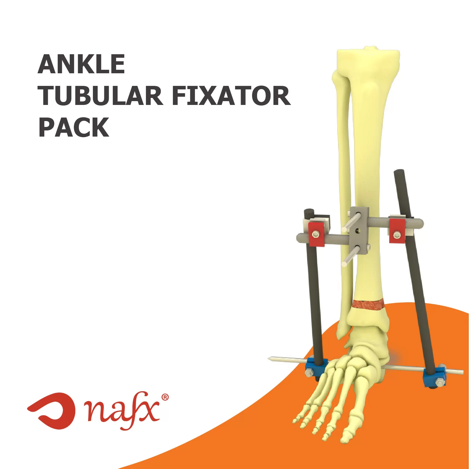 External Fixation System - Large Tubular Fixator