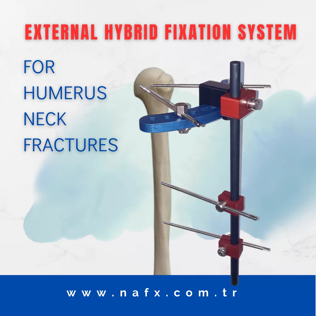 External Fixation System Large Tubular Fixator