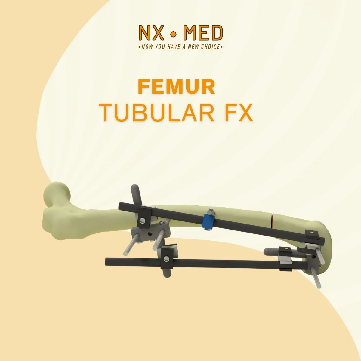 External Fixation System - Large Tubular Fixator