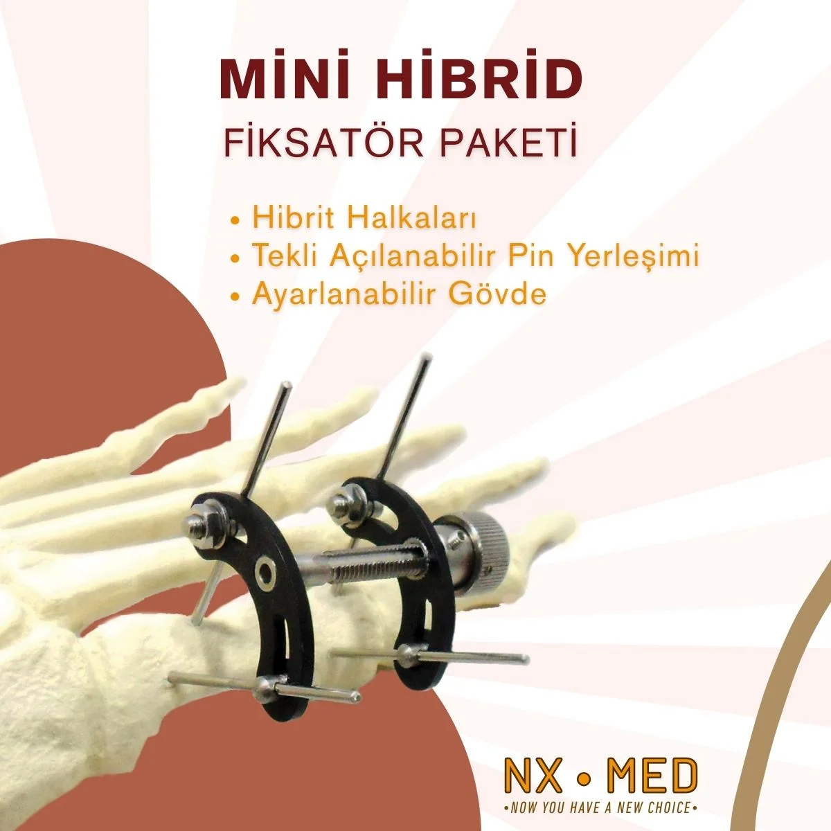 Mini Fiksatörler - Falanks, Metakarpal ve Metatarsal Fiksatör Sistemleri