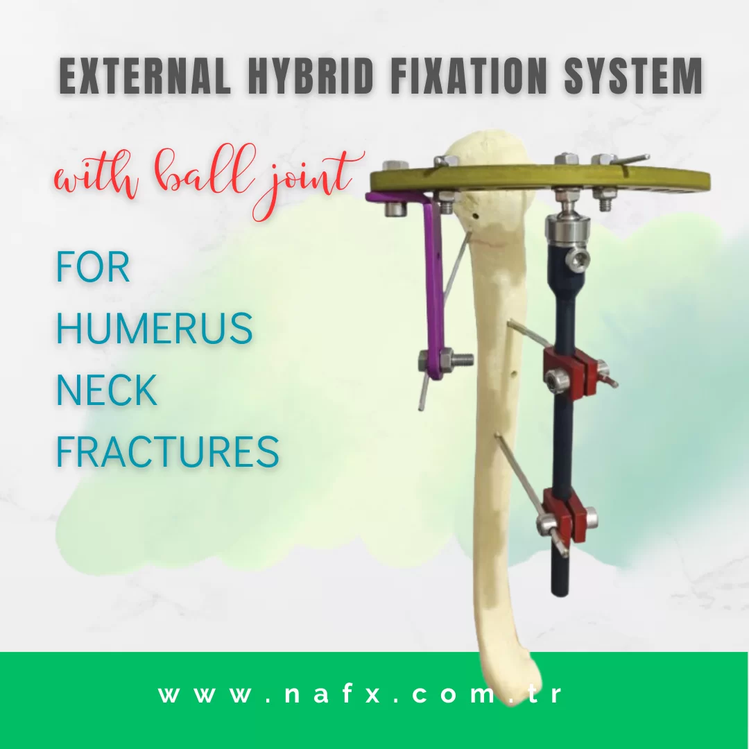 External Fixation System Large Tubular Fixator
