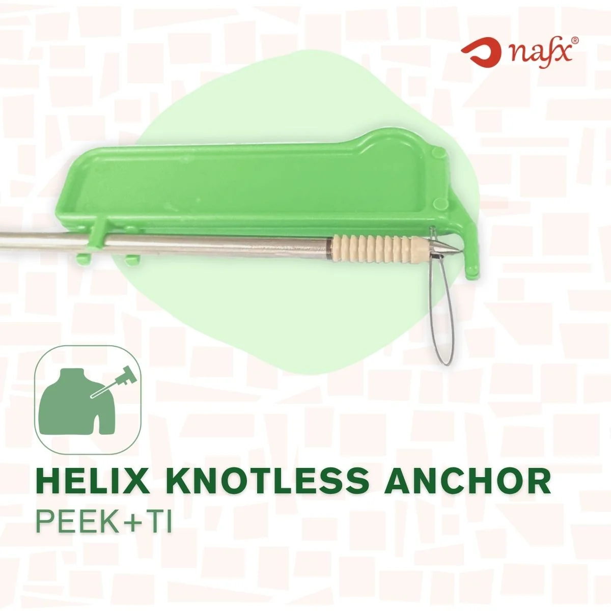 PEEK-Ti Knotless PushLock Anchor for Arthroscopic Fixation
